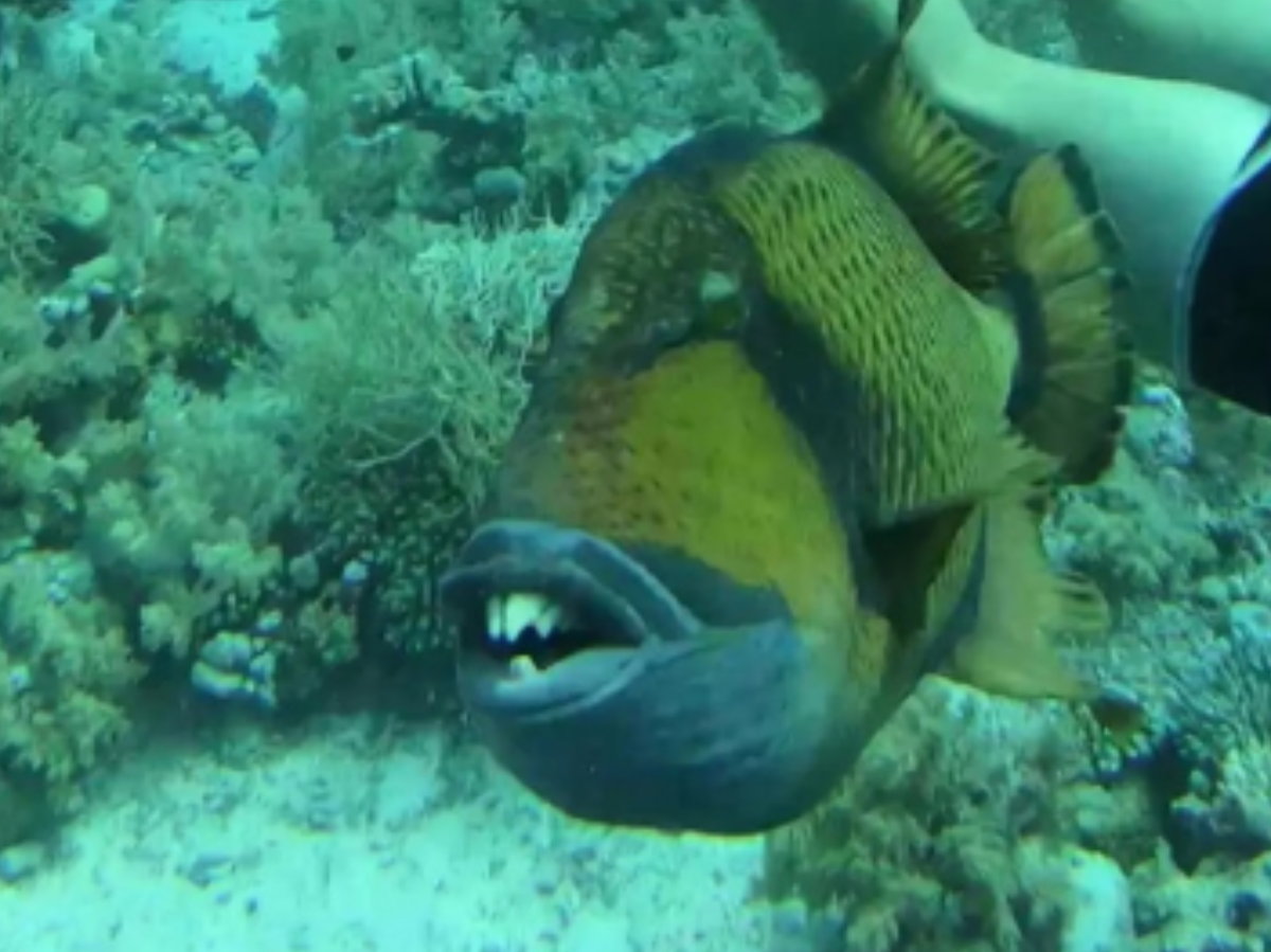Triggerfish Bit A Scuba Diver Underwater