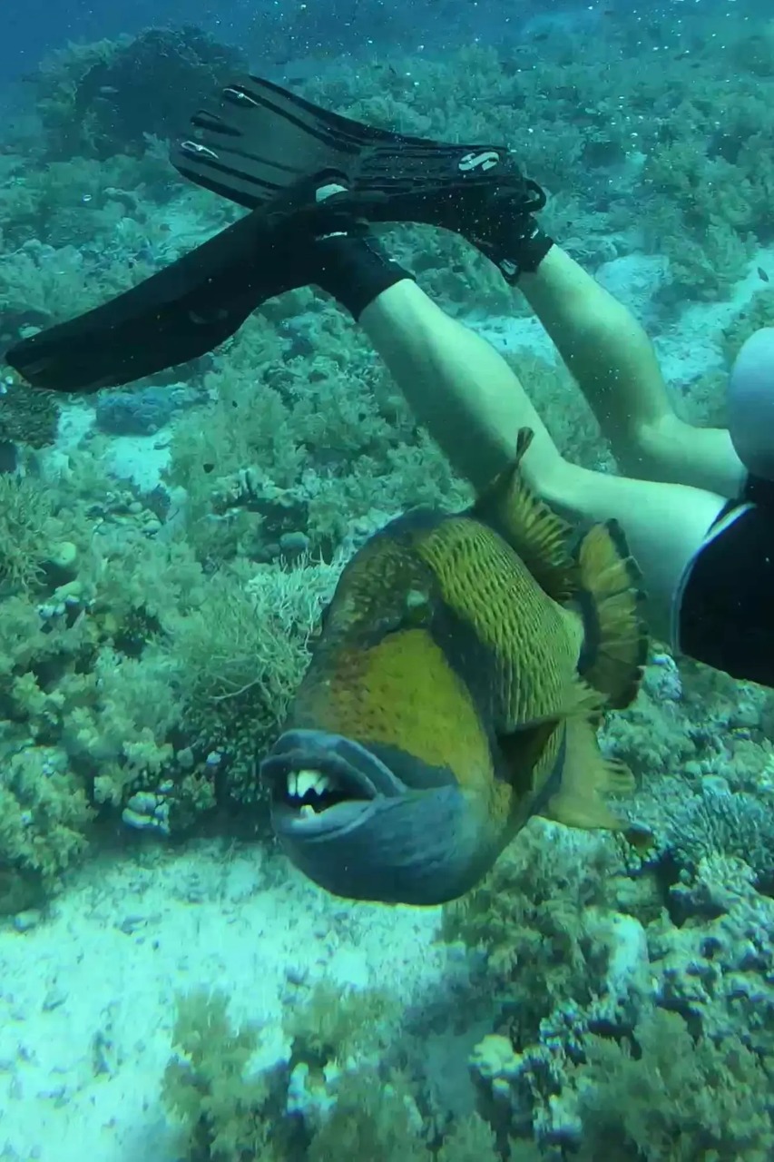 Triggerfish Bit A Scuba Diver Underwater