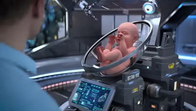 How Will Ectolife, World’s First ‘Artificial Womb Facility' Work?