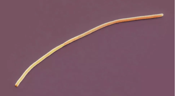 World's Biggest Bacteria Ever Discovered Is A 2-Centimetre Long String