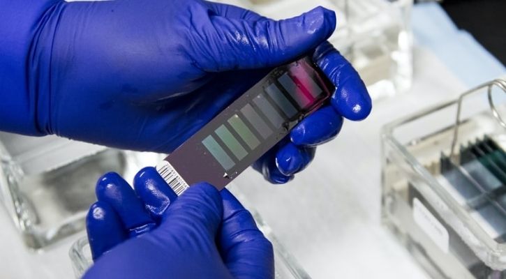 Mumbai Startup Develops Universal Disease Test For All Infections ...