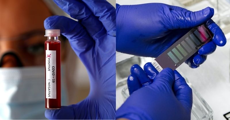 Mumbai Startup Develops Universal Disease Test For All Infections ...