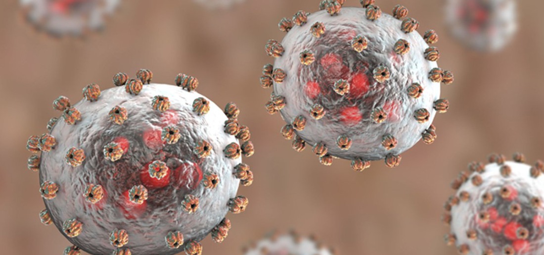 First Confirmed Case Of Rare Rat-borne Disease Lassa Virus