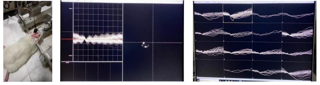 Indian Scientists Develop Novel Tool To Understand How Long-Term Memory ...