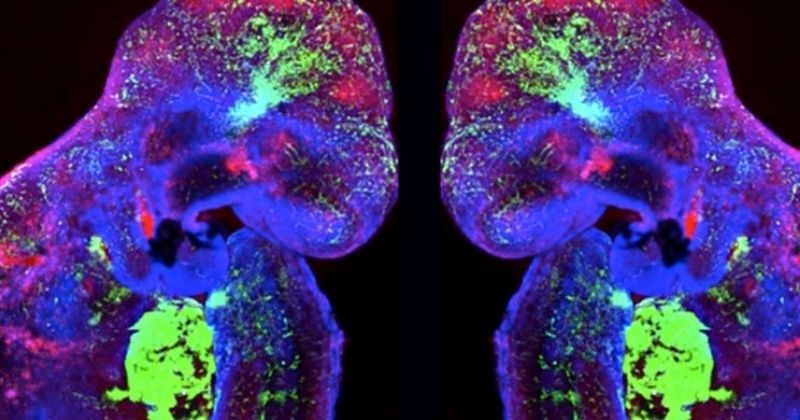 Scientists Have Devised An Improved Way To Cultivate Human Organs In A Lab