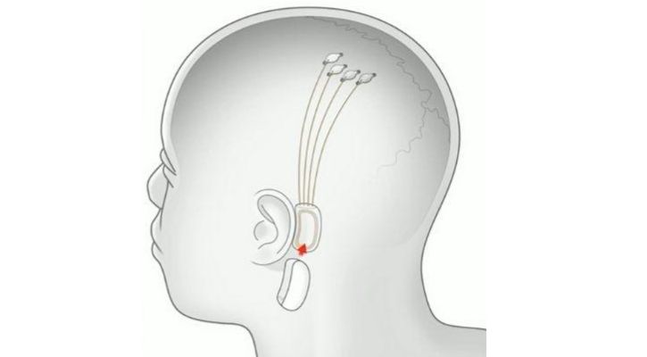 Paul Merolla, Chief Design Executive Behind Musk's Neuralink Quits Company