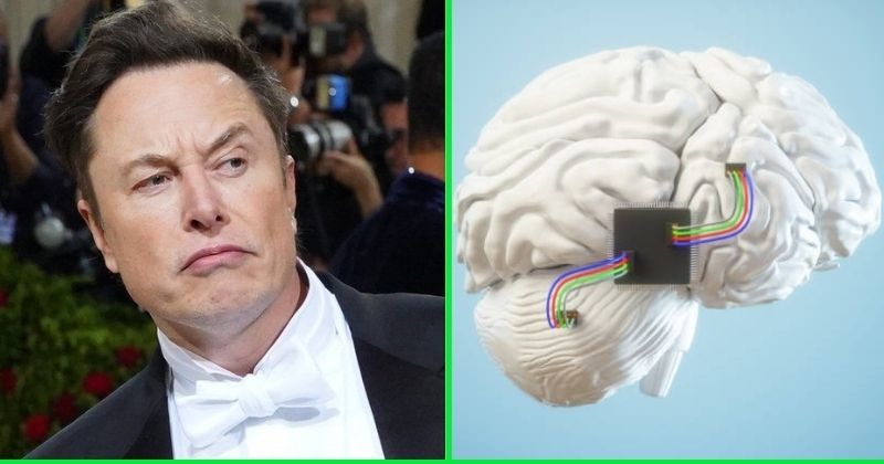 A Startup Beat Elon Musk's Neuralink With Its Brain-Computer Interface ...
