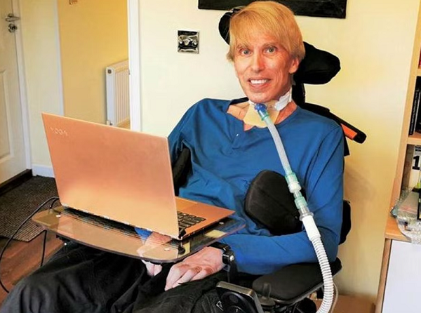 'World's First Cyborg,' Dr Peter Scott-Morgan, Dies At Age 64