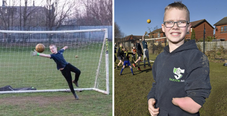 Boy born without forearm becomes star goalkeeper for local football team