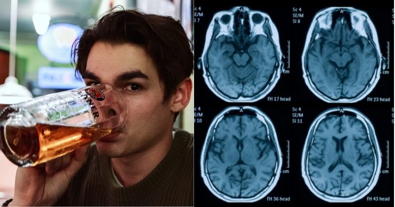 Drinking Two Beers A Day Damages Brain As Much As Ten Years Of Aging