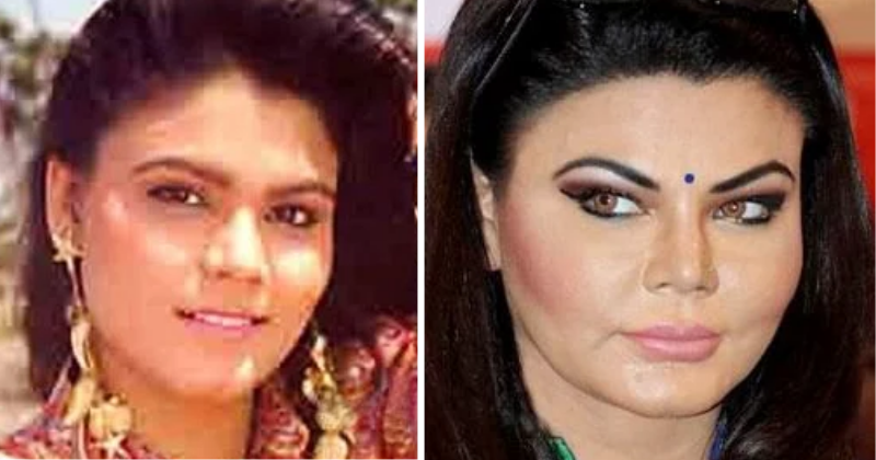 Rakhi Sawant Underwent Breast Surgery At The Age Of 16 Calls It