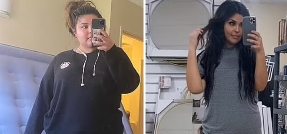 Woman Shocked To Discover Tumour With Hair & Teeth