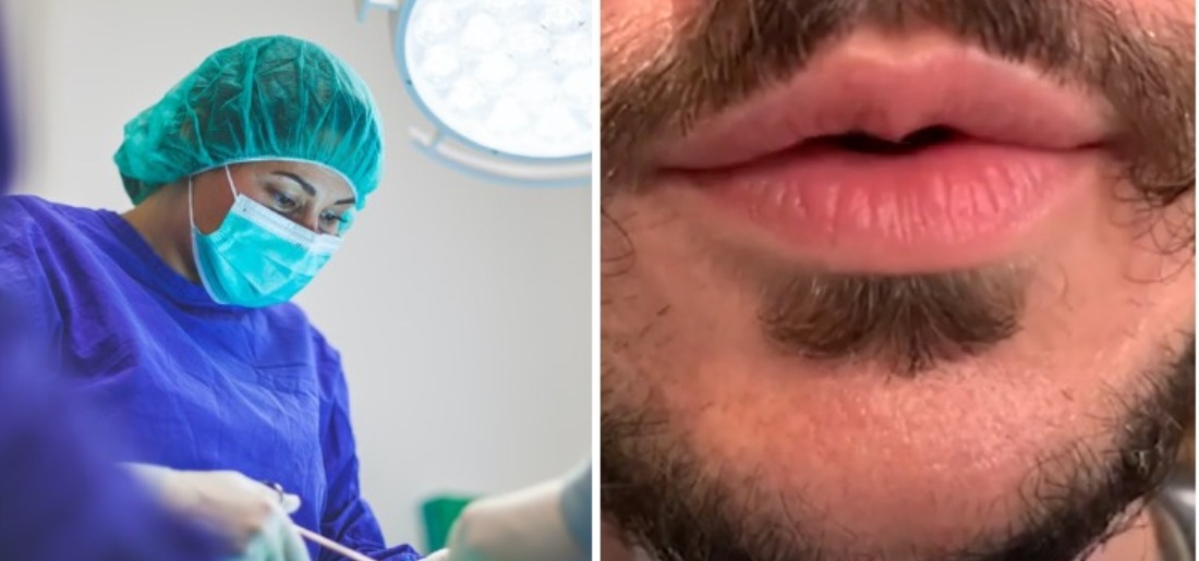 Man Who Sounded Like 13-YO Gets Voice Back Post Surgery