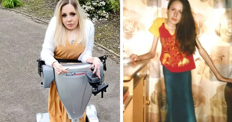 Woman With Rare Medical Condition Can't Sit
