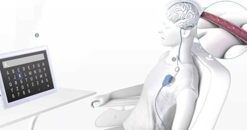 Brain Sensor Implant Helps Paralysed Individuals Control An iPad Using ...