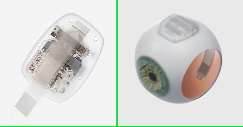 Neuralink Co-Founder's New Rival Company Requires No Hole-Drilling In ...