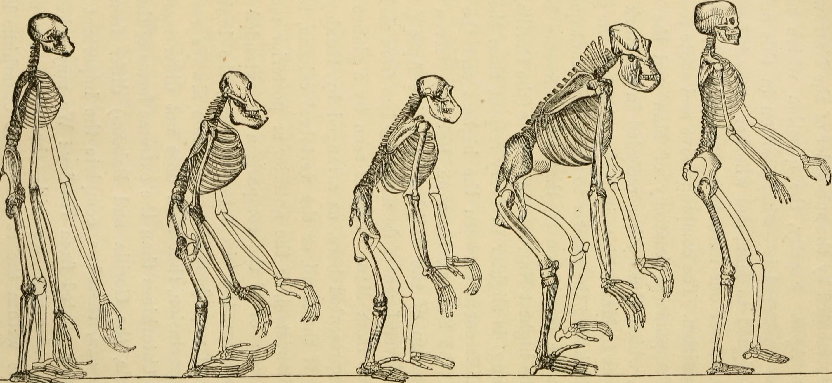 Baby Girl Born With Tail Gets The Body Part Removed