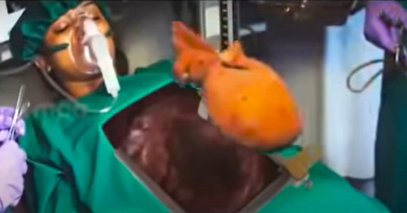 Telugu Film Hilarious Heart Transplant