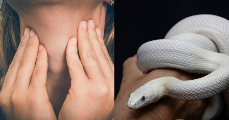 Terrifying Video Shows Doctors Pulling Out 4-Feet-Long Snake From Woman ...