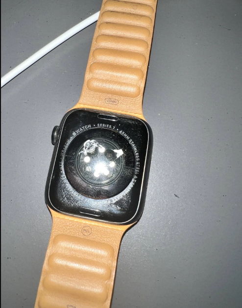 Apple Watch Exploded After Overheating And The Company Tried To Keep It ...