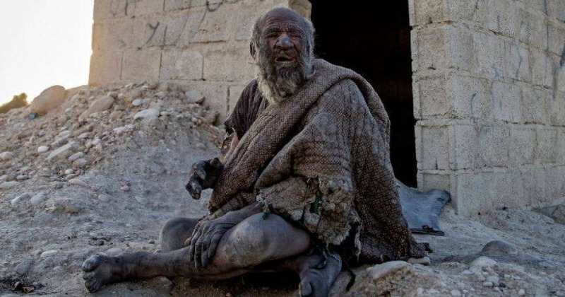 'World's Dirtiest Man' Dies At 94 After His First Bath