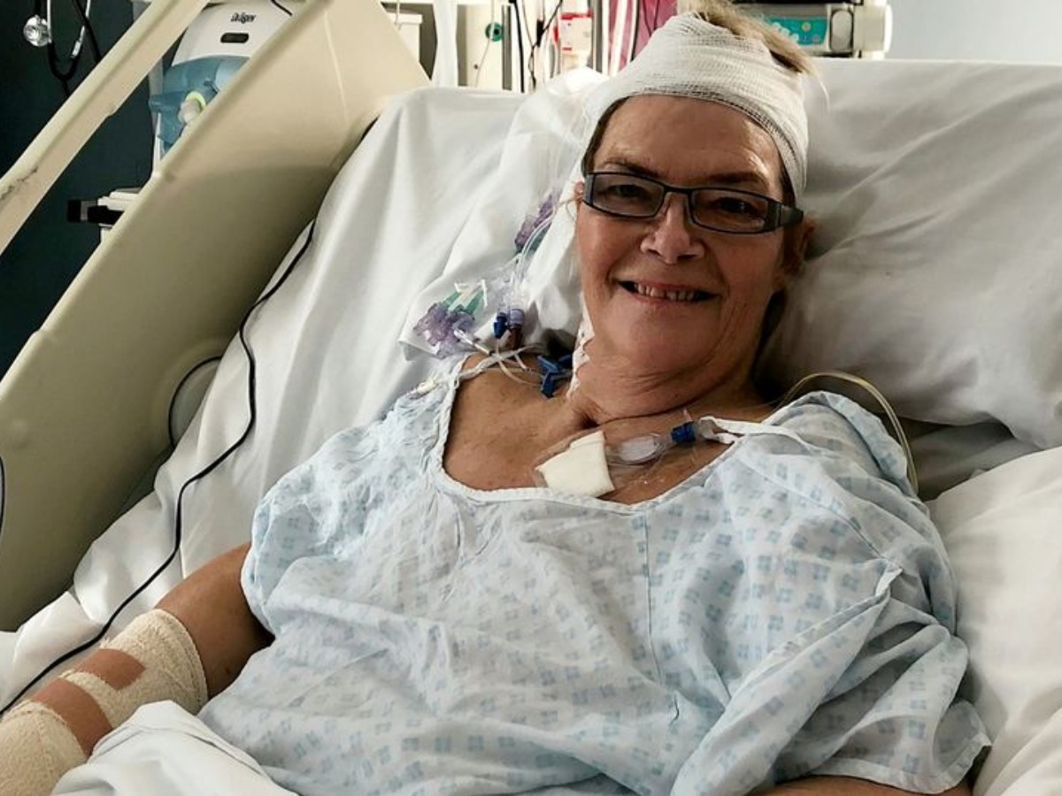 Woman Gets Double Hand Transplant