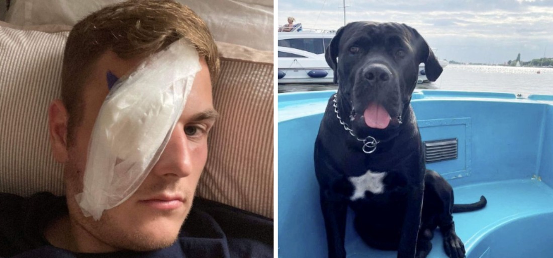 Man Saves Drowning Dog From River, Dog Bites His Face