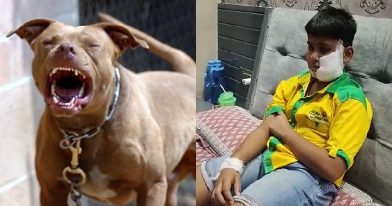 Pit Bull Strikes Again! Leaves 11-Year-Old Ghaziabad Boy With Over 150 Stitches On His Face