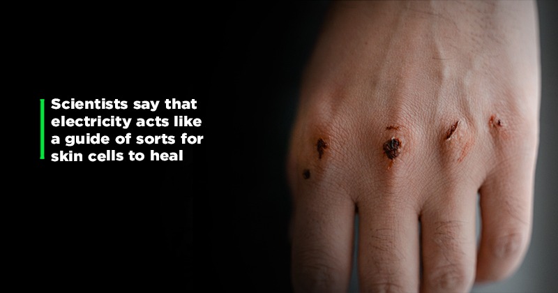 Electricity Accelerates Chronic Wound Recovery By Threefold, Study Reveals