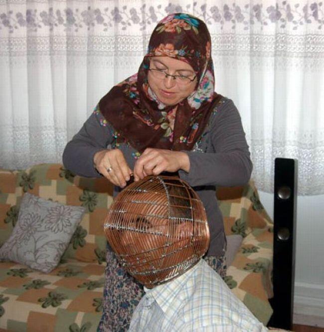 Story Of Turkish Man Who Caged His Head To Quit Smoking