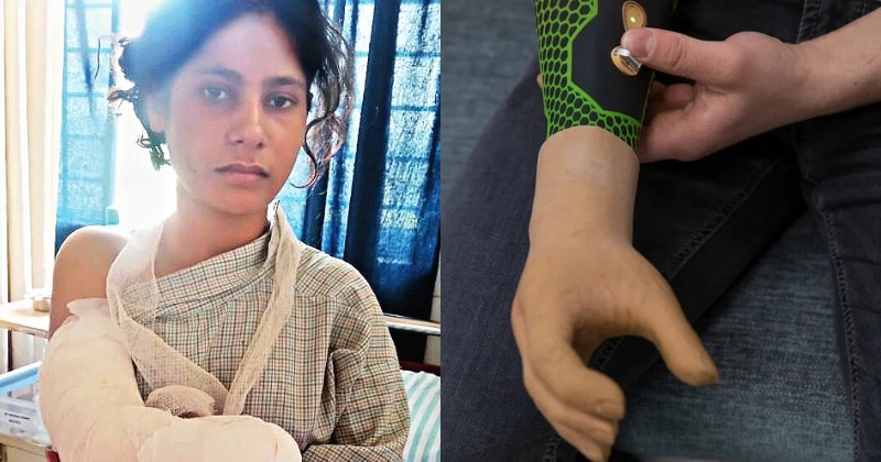 Hand Chopped Off By Husband To Prevent Her Taking Up A Govt Job, Woman ...