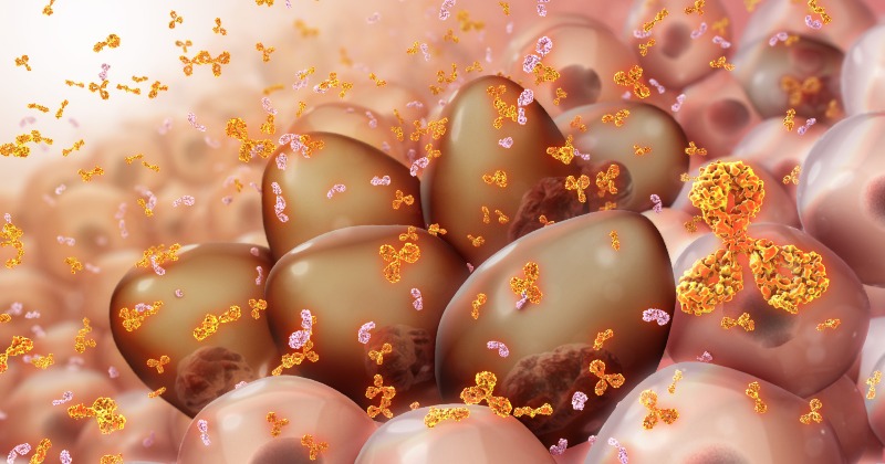 Explained: What Is Multiple Myeloma And How Can It Be Diagnosed?