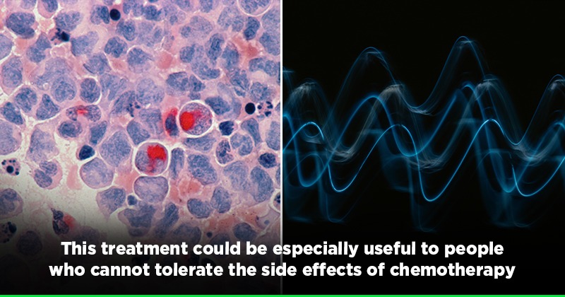 Researchers Use Sound Waves To Target And Destroy Cancer Tumours