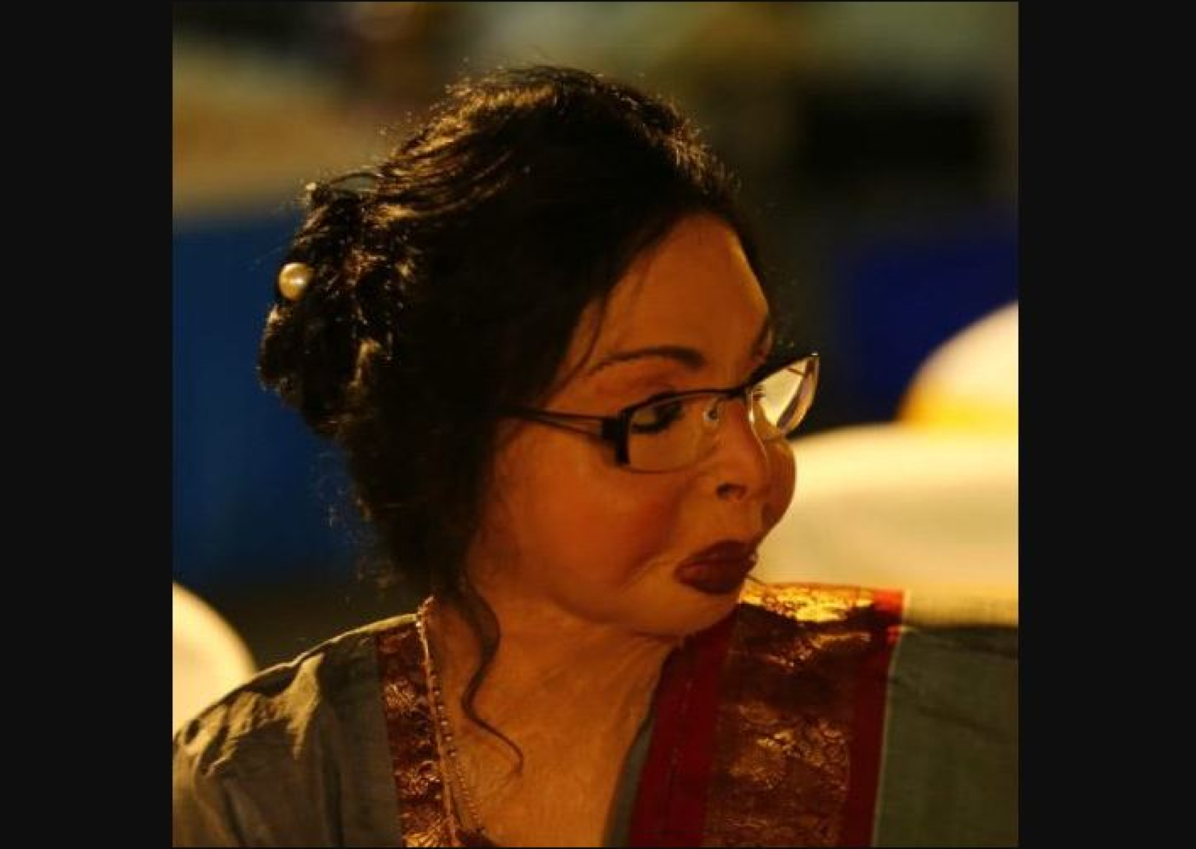 Girl Who Suffered Serious Burn Injury At 8 Becomes A Doctor, Now ...