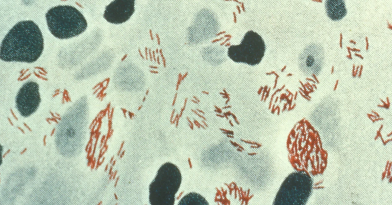 Leprosy Could Become Endemic In Florida: Here's What We Know - TrendRadars