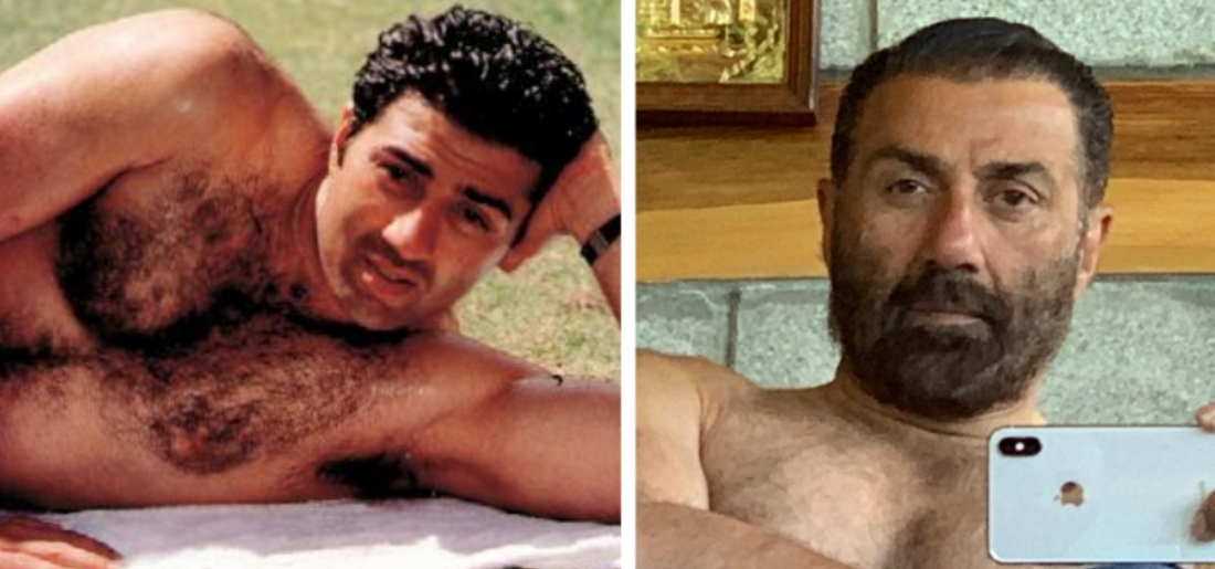 Sunny Deol Says Actors Look Like Girls After Shaving Body Hair: 'Mujhe ...