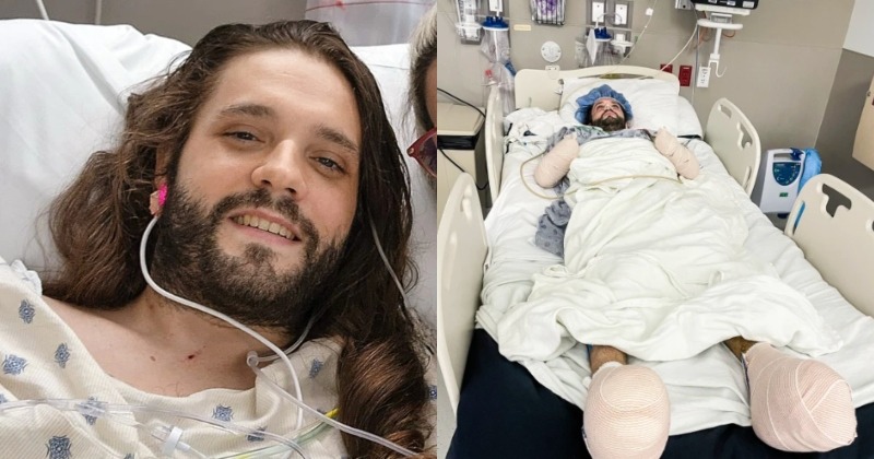 US Man Loses Both His Hands, Feet From A Single Flea Bite: Here's How ...