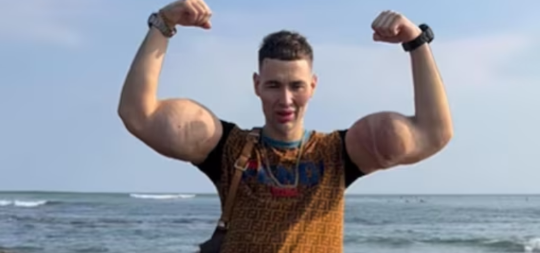 Russian Man With Biceps Like Popeye's Goes Viral