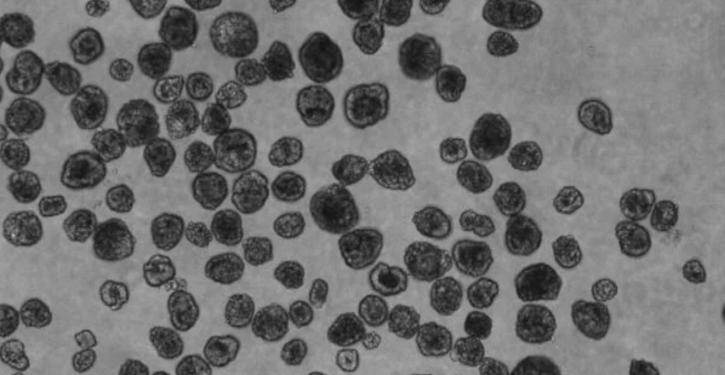 Scientists Create Tiny Robots Called 'Anthrobots' From Human Cells