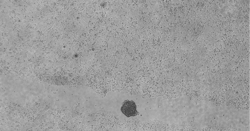 Scientists Create Tiny Robots Called 'Anthrobots' From Human Cells