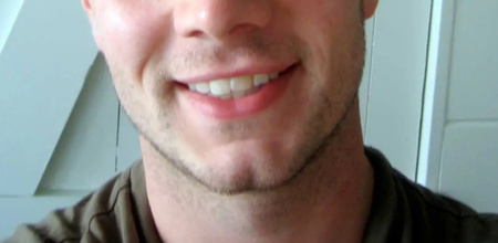 What Are Chin Dimples?