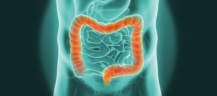 India Sees A Surge In Cases Of Colorectal Cancer, Experts Recommend ...