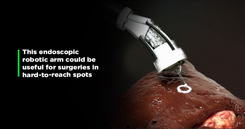 This Robotic Arm Can Perform Surgery And 3D Print Inside The Human Body ...