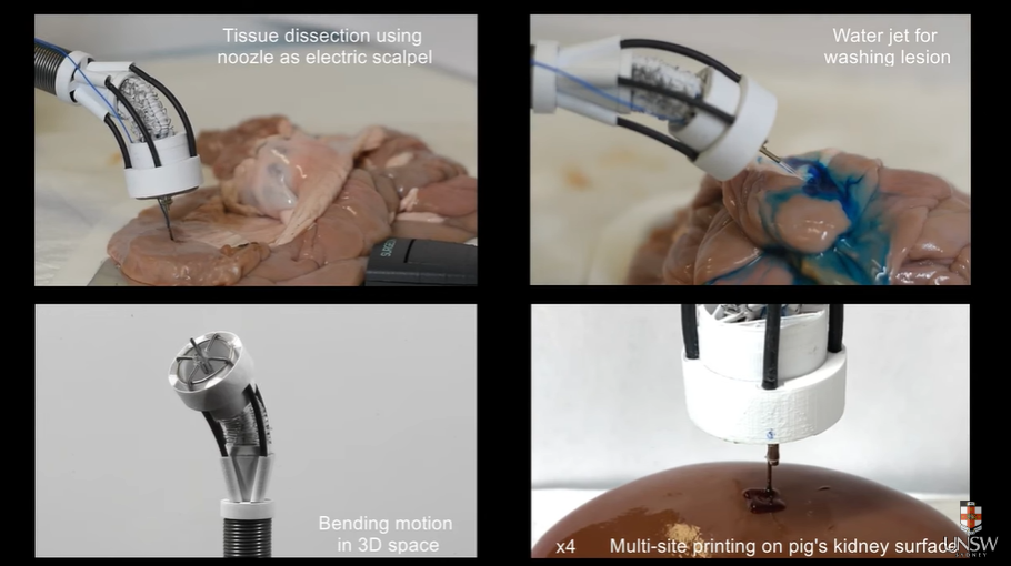 This Robotic Arm Can Perform Surgery And 3D Print Inside The Human Body