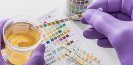 Explained: Yellow, Red Or Pink: What Your Urine Colour Says Lot About ...