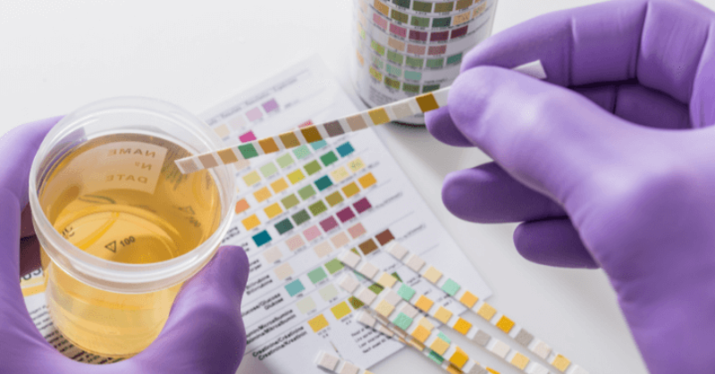 Explained: Yellow, Red Or Pink: What Your Urine Colour Says Lot About ...
