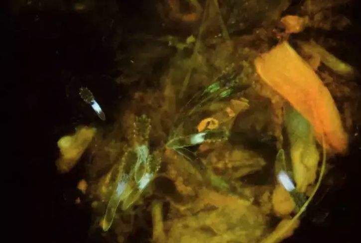 Footage Reveals Microscopic Creatures On Your Skin That Come Out At Night