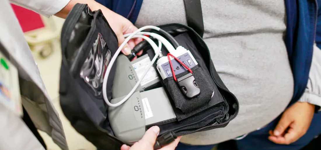 Explained: Overcoming Stigma And Misconceptions About LVADs For Heart ...