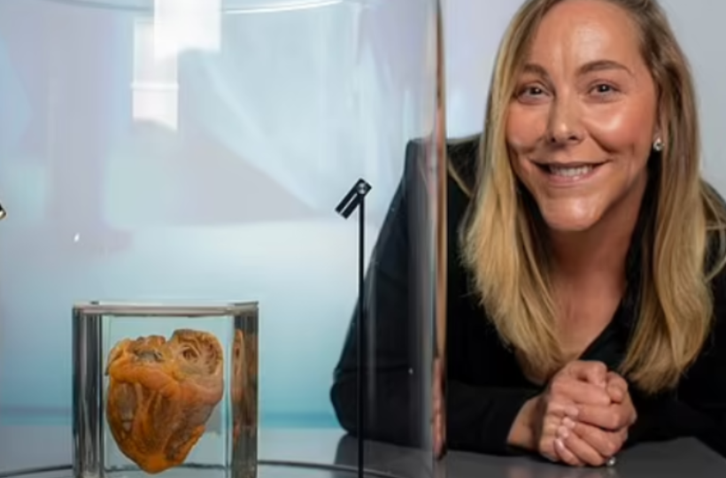 Oddest reunion ever: Woman sees her own heart on display at a museum ...