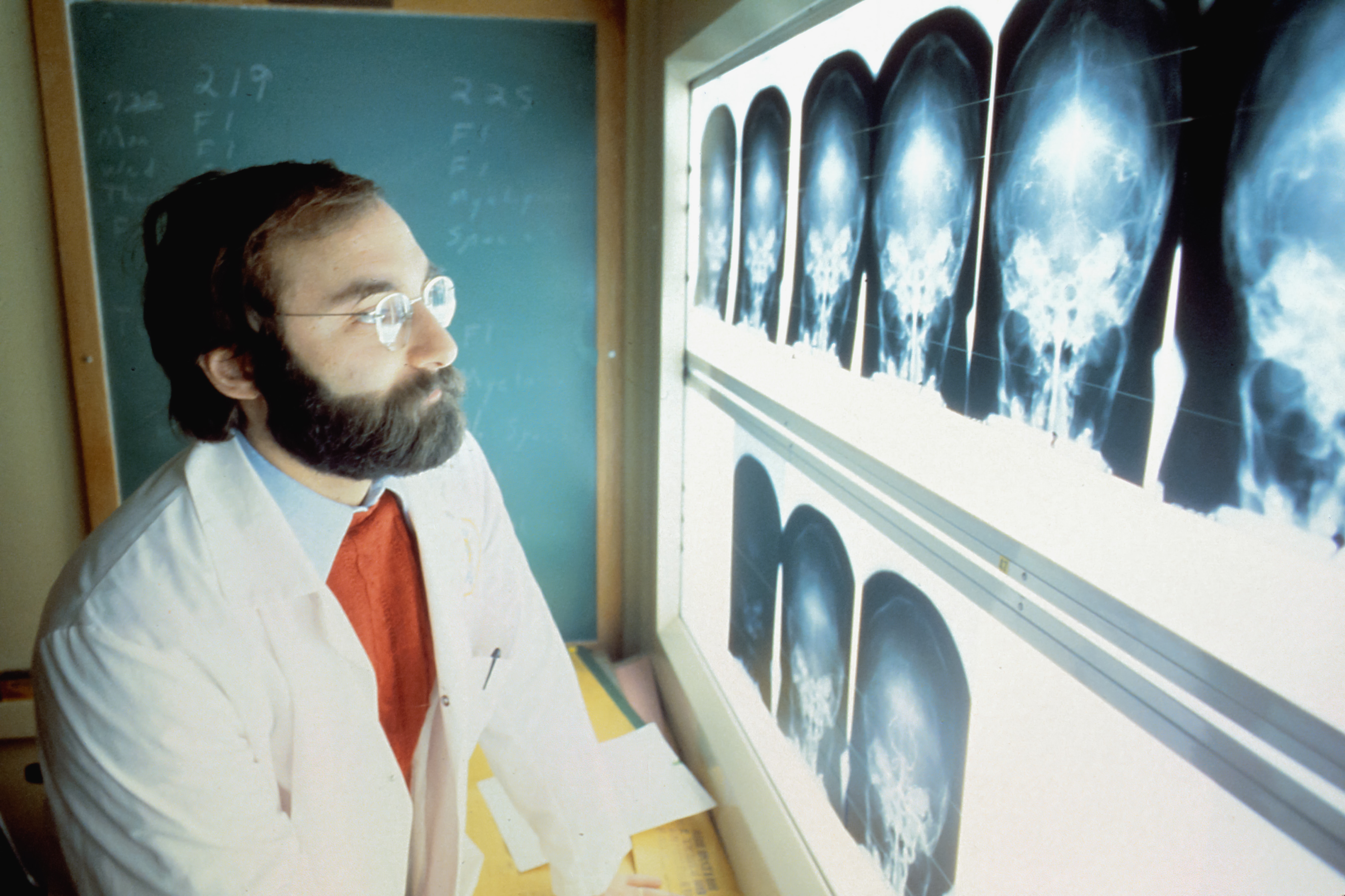 World Radiology Day: Why Radiology Is A Lucrative Profession In India ...